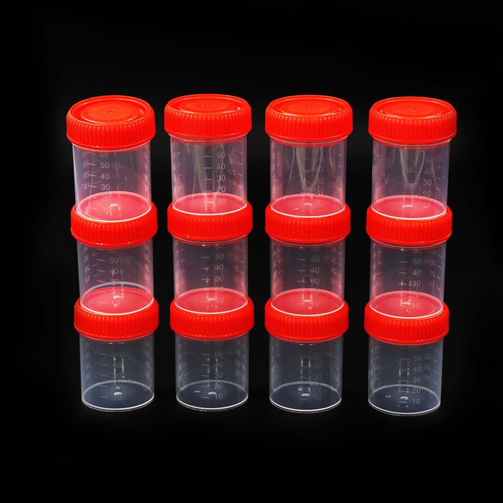 ULAB Scientific Specimen Container and Rack Set, 12pcs of Red Cap ... ULAB Scientific Specimen Container and Rack Set, 12pcs of Red Cap ...
